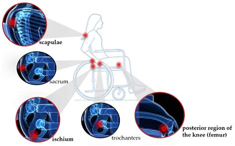 Sensor Cell Network For Pressure Temperature And Position Detection On Wheelchair Users