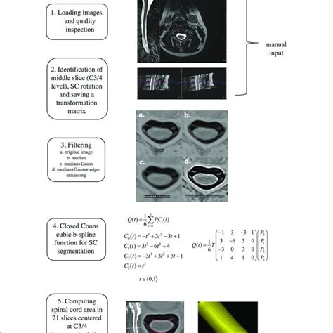 Schematic Representation Of The Proposed Pipeline For Spinal Cord Download Scientific Diagram