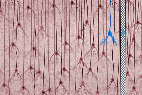 Whats Next For Brain Directed Gene Therapy After Death In Neurogene