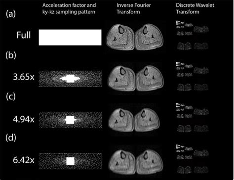 Examples Of Variable Density Undersampling Patterns With Different