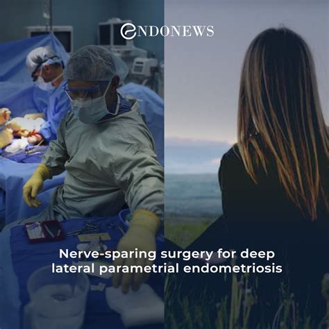 Deep Lateral Parametrial Endometriosis Nerve Sparing Surgery Endonews