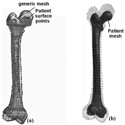 The Mesh Matching Algorithm Applied To Entire Femora A The External