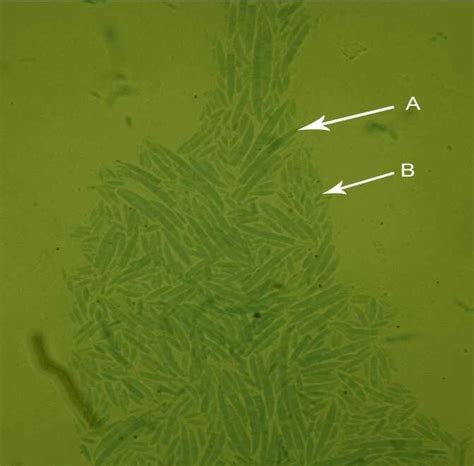 Microconidia B And Macroconidia A In Fusariumoxysporum Left