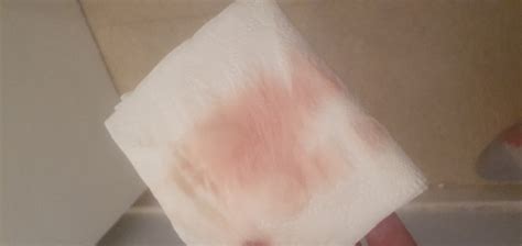 Implantation Bleeding Colour