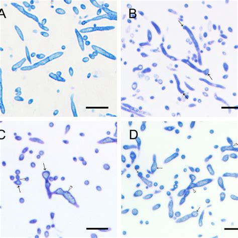 In Vitro Antifungal Activity Of Polyenes Against Valsa Mali Download Scientific Diagram