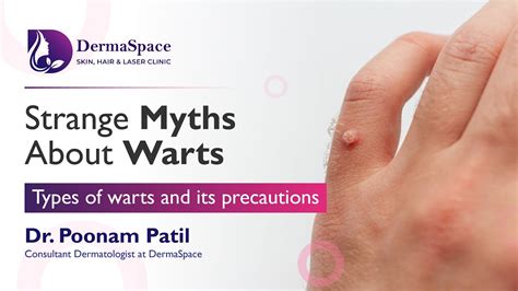 Strange Myths About Warts Types Of Warts And Its Precautions Dr Poonam Patil Dermatologist