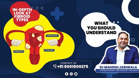 In Depth Look At Fibroid Types What You Should Understand Youtube