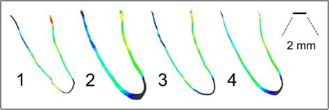 Influence Of Different Modeling Strategies For The Periodontal Ligament On Finite Element