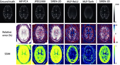 Compression Quality Of An Exemplar Dataset Mgh1001 The First Row Download Scientific Diagram