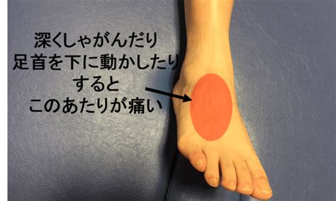 足薬指関節痛い 左手中指の第二関節が痛い Nniwk