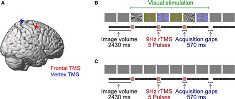 Figure 1 From Concurrent Tms Fmri And Psychophysics Reveal Frontal Influences On Human