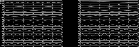 Examples Of Dictionary Atoms Selected With The Use Of 1 D K Svd