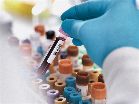 HDL Levels Healthy Ranges Of Good Cholesterol And How To Raise It