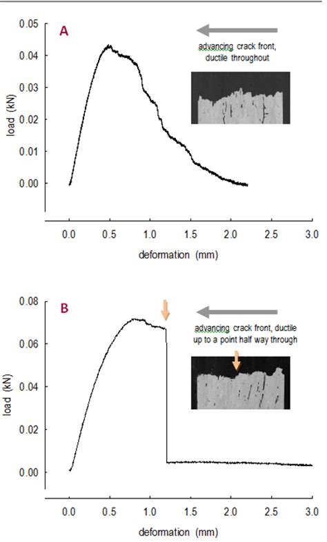 Open Access Ageing Bone Fractures The Case Of A Ductile To Brittle