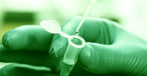 DNA Analysis The Gold Standard Finding My Irish