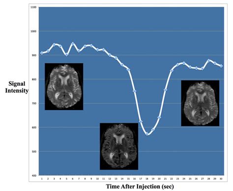 Magnetism Questions And Answers In Mri