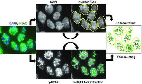 Steps Involved In Image Processing For Analysis Of γ H2ax Foci Imagej Download Scientific