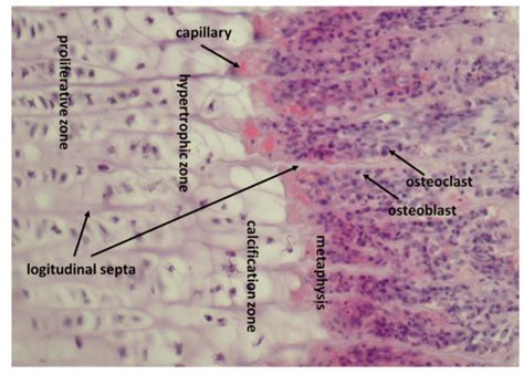 Intramembranous Ossification Histology