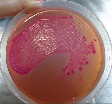Acinetobacter On Blood Agar