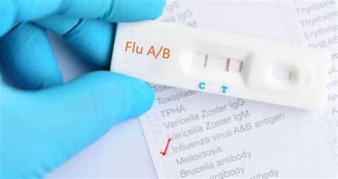 Ridt Vs Rt Pcr Vs Viral Culture For Flu Testing