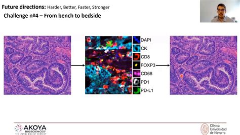 A Ready To Analyze High Plex Spatial Signature Development Workflow For