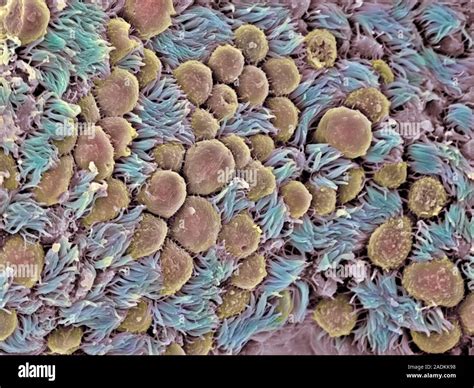 Fallopian Tube Coloured Scanning Electron Micrograph SEM Of The Epithelial Lining Of A