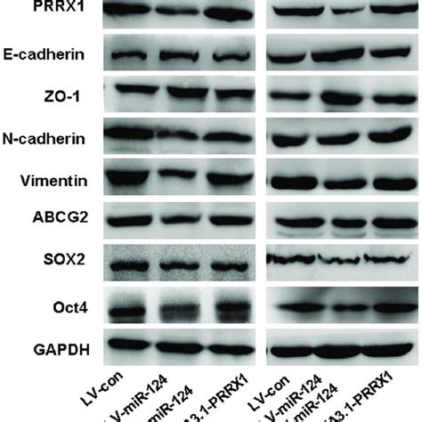 Detecting Emt And Stemness Related Genes Expression By Western Blot