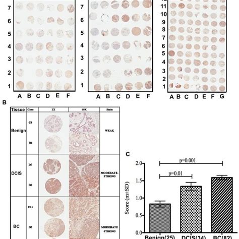 A Tissue Microarrays Tma Containing Tissue Sections Representing Download Scientific Diagram