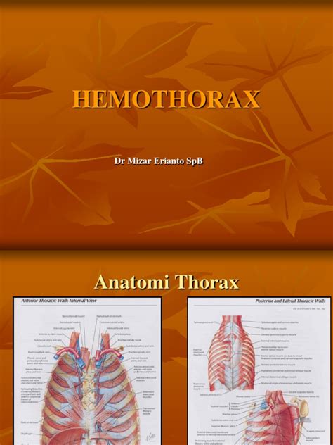 Hemothorax Diagnosis Dan Terapi Pdf Sains And Matematika
