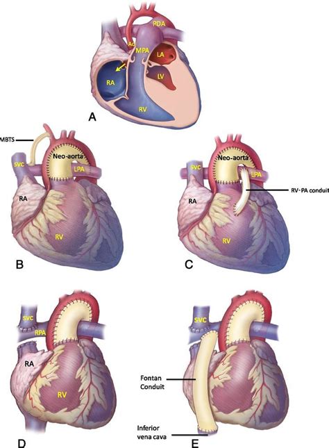 Cardiac Devices Cardiac Medical Device Devices