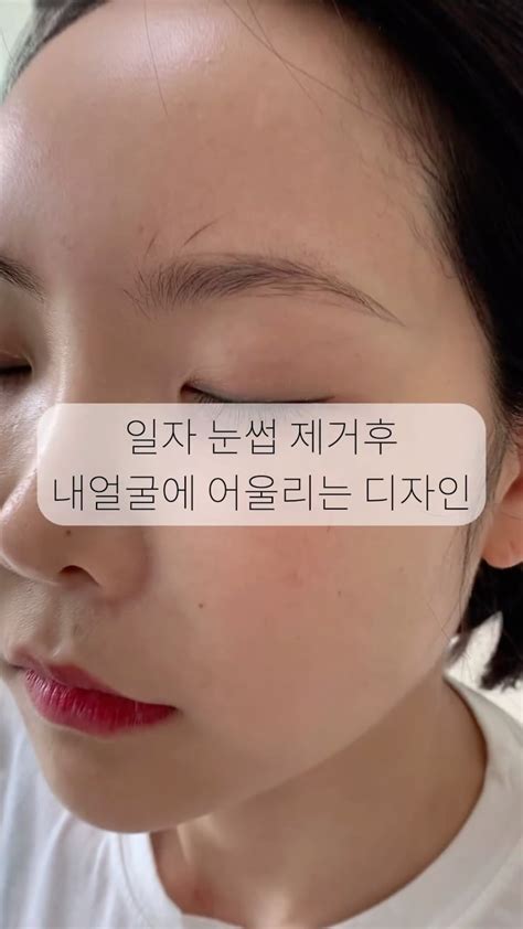 뷰티해온 강남눈썹문신 잔흔제거 눈썹문신제거 眉毛アート除去 잔흔제거수강 Haeon • Instagram Photos And Videos