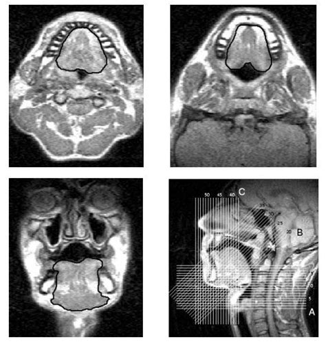 Professional Tongue Visualization For Mri — Matlab Number One