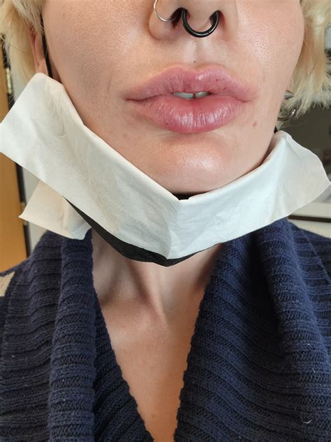 Fresh First Time Bimbo Lips 💋 Rbimbofetish