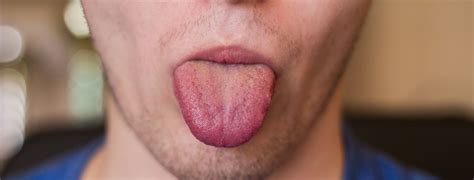 Why Are My Lips And Tip Of Tongue Numb Lipstutorial Org