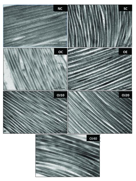 Electron Micrograph Tem Of Rat Skin Collagen Fibrils Of The Dermis Download Scientific