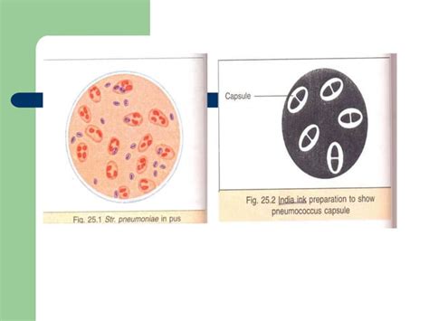Pneumococcus Ppt