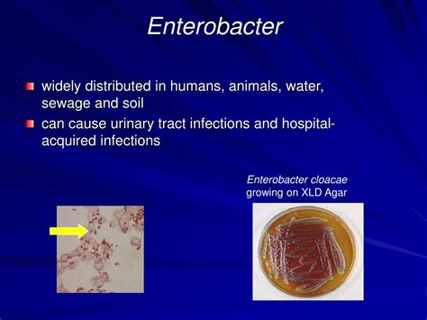 Ppt Diversity Of Prokaryotes Powerpoint Presentation Free Download
