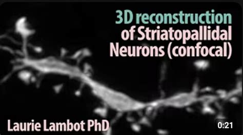 3d Visualization Of A Striatopallidal Neuron Dendrite Confocal