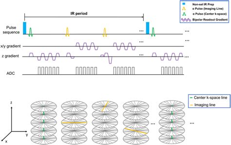 a pulse sequence diagram for the proposed mt‐me technique