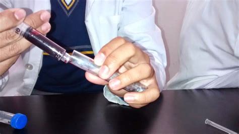 RetracciÓn Del Coagulo