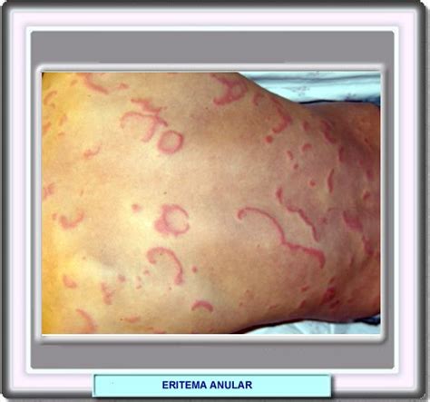 Atlas De Dermatologia