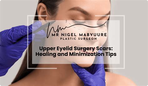 Upper Eyelid Surgery Scars Healing And Minimization Tips Dr Nigel