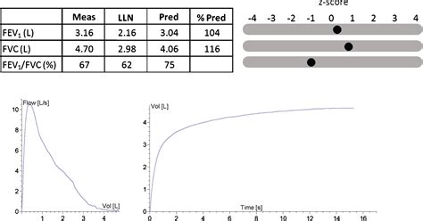 Spirometry Report Sample At Hudson Slattery Blog
