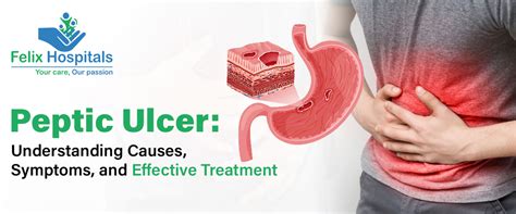 Peptic Ulcer Causes Symptoms And Effective Treatment