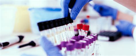 Procedure Coding When To Use The 91 Modifier Continuum