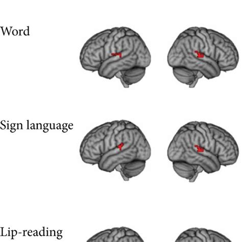 Activations In The Superior Temporal Cortex In Response To Visual Download Scientific Diagram