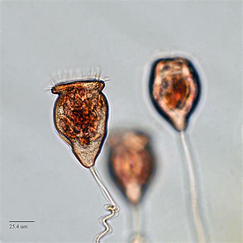 Vorticella Microscope