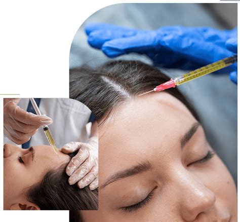 Exosomes Bacterial Therapy Clear And Heal Troubled Skin