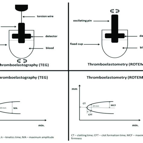 Thromboelastography Teg And Rotational Thromboelastometry Rotem