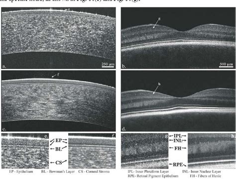 Figure 2 From Efficient Reduction Of Speckle Noise In Optical Coherence